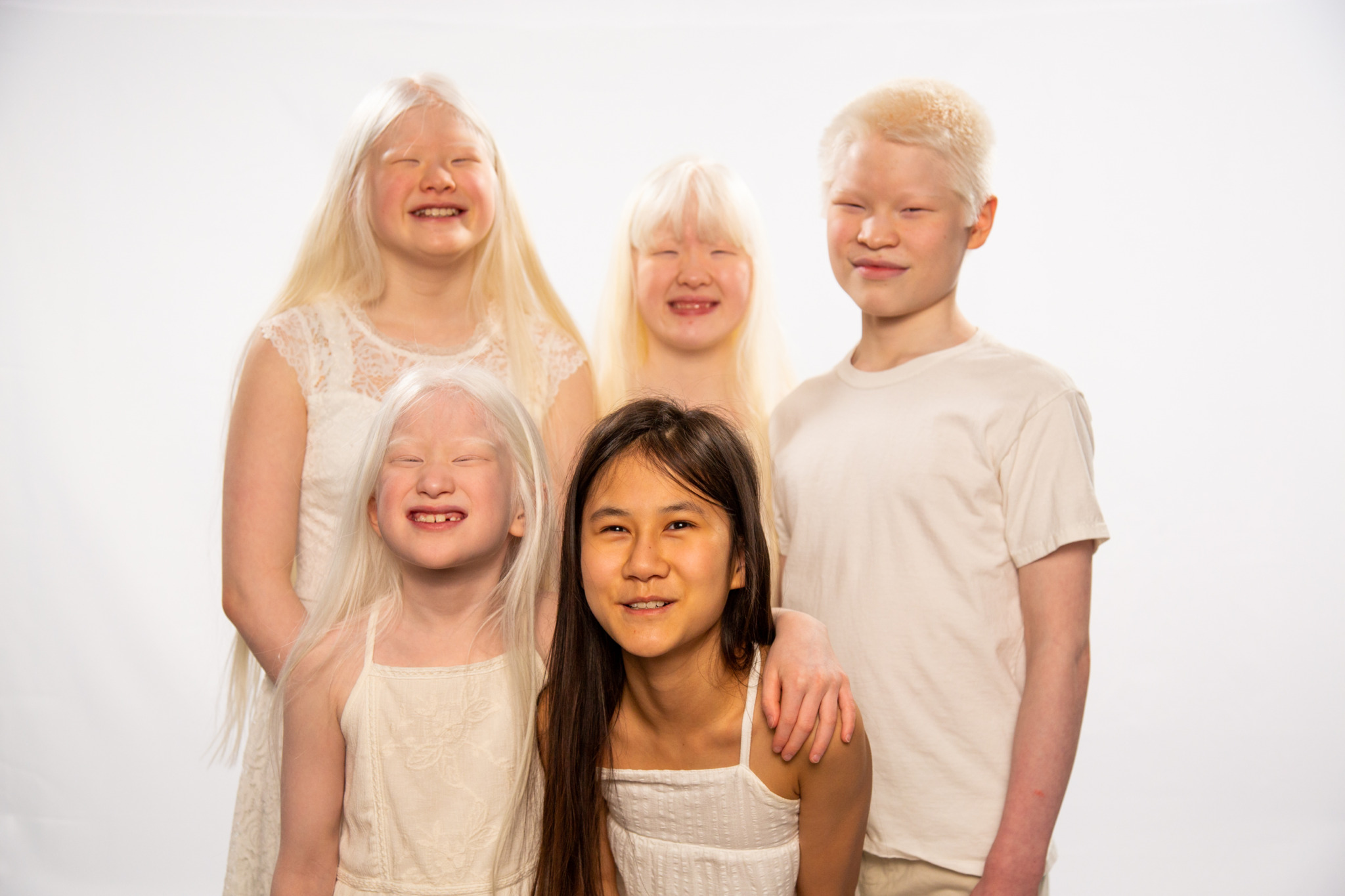Born with Albinism - Bell Media